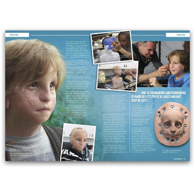 Prosthetics Magazine